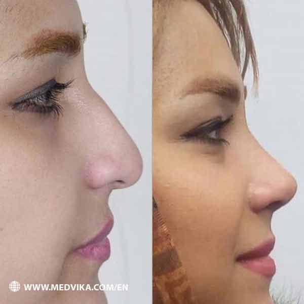 Dr Mehdi Ramezani Aval | Cosmetic and Plastic Surgeon