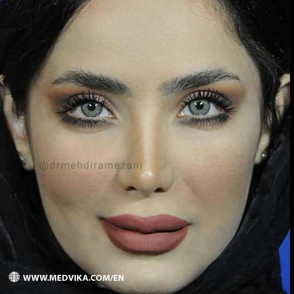 Dr Mehdi Ramezani Aval | Cosmetic and Plastic Surgeon